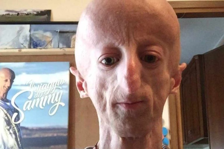 Gli ultimi istanti di vita di Sammy Basso raccontati dal ristoratore ...